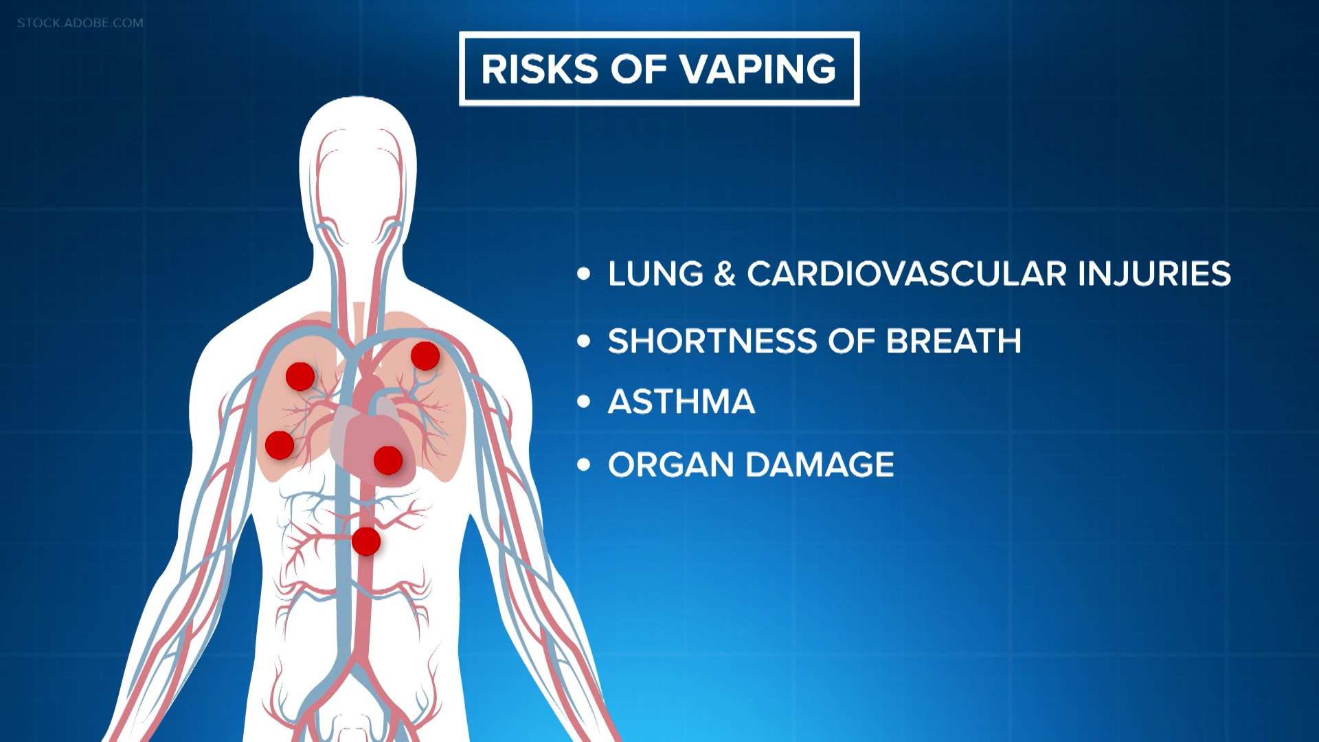 Indiana schools working to stop student vaping | wthr.com