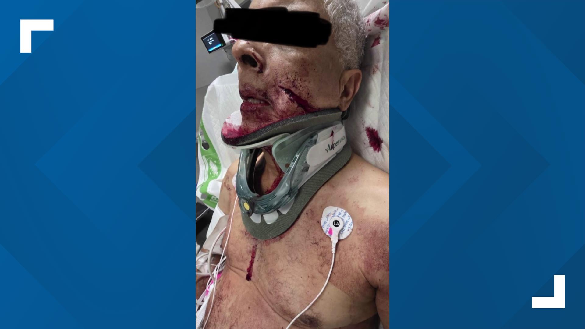 FOX Corporation seeks to move Mark Sanchez lawsuit from civil case to ...