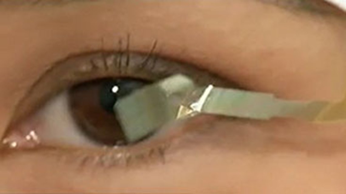 Artificial retina study brings hope for restored sight | wthr.com