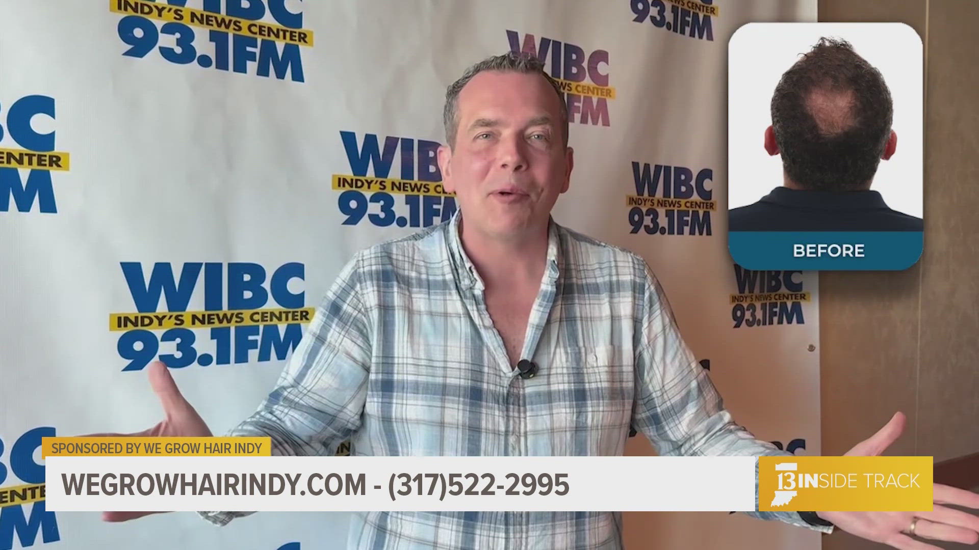 Indianapolis radio personality Jason Hammer to undergo hair restoration ...