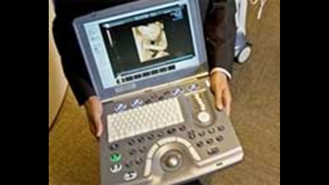 Small ultrasound machines help patients | wthr.com