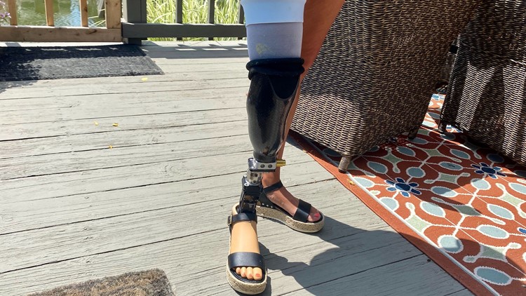Woman thanks IFD for saving her prosthetic leg | wthr.com