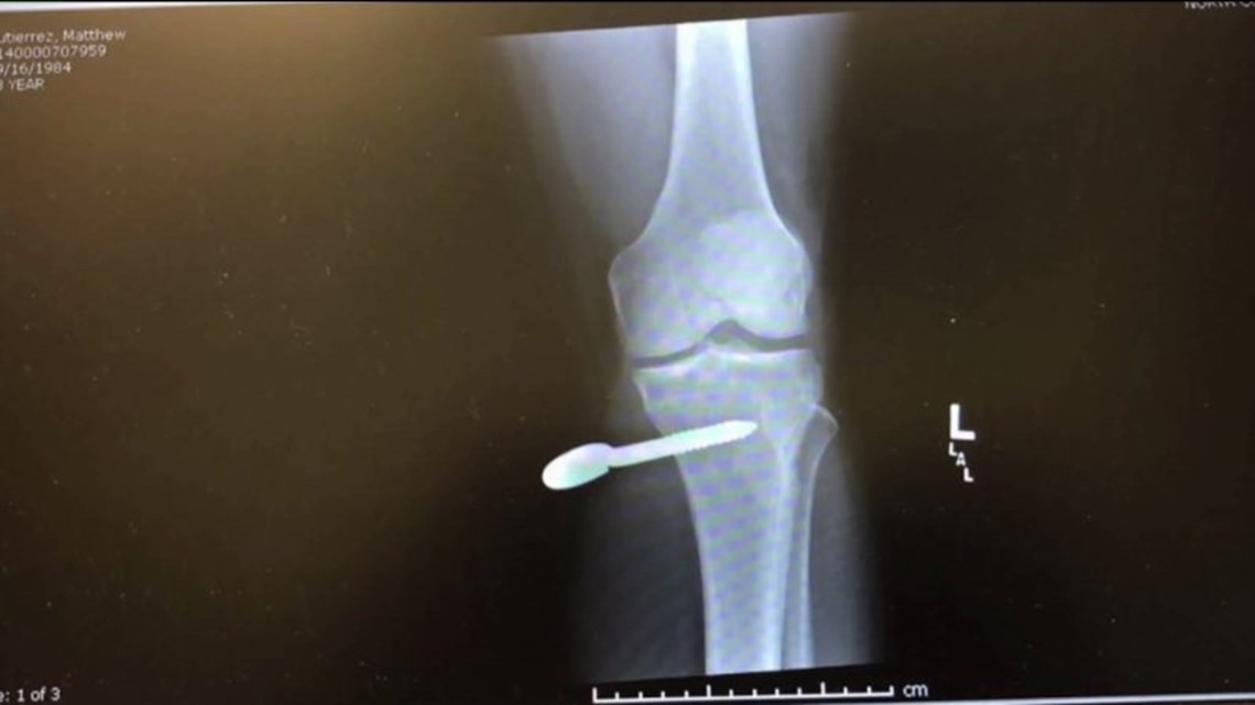Golfer’s leg impaled by large bolt in freak accident | fox61.com