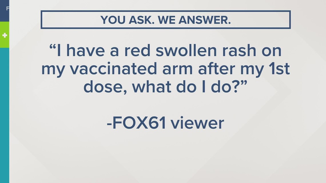 You ask. We answer. | What to do if you get a rash from 1st COVID-19 ...