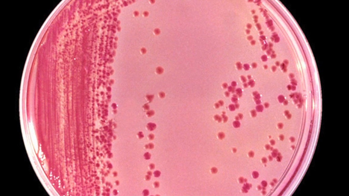 Ask The Pharmacist – CRE Superbug Infections | fox61.com