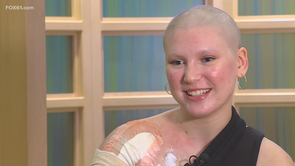 Connecticut teen with rare bone cancer raises research funds | fox61.com