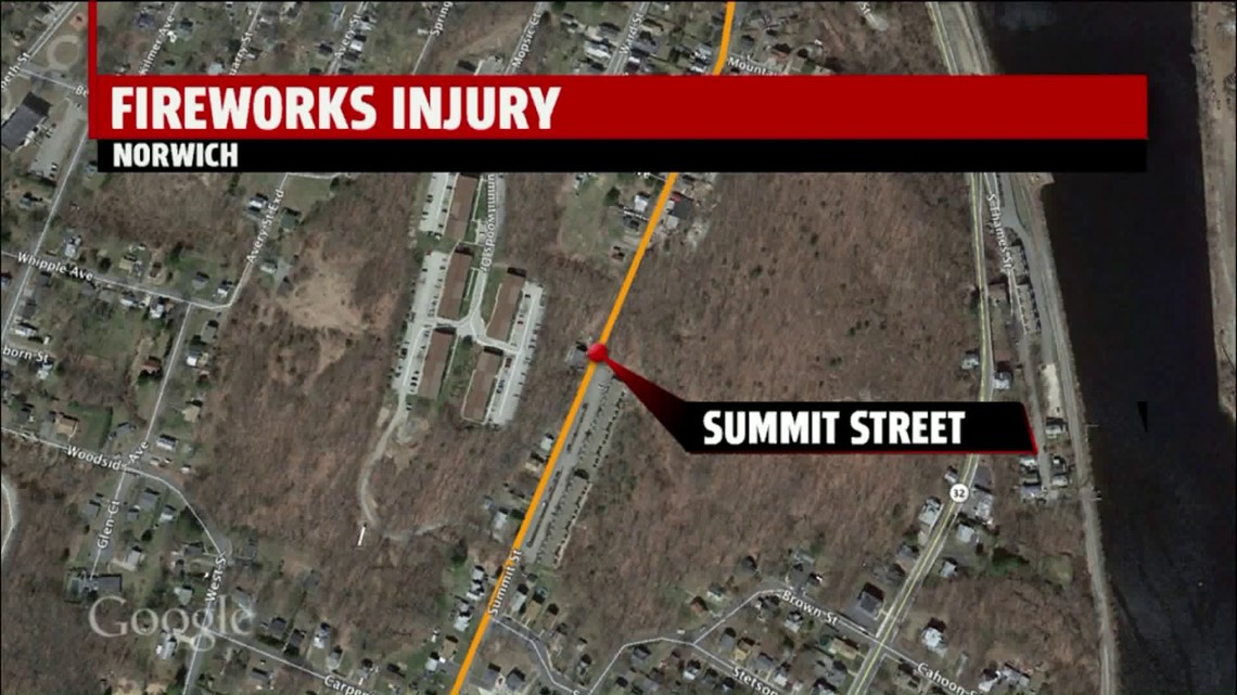 Norwich man dislocates fingers when firework explodes in his hand ...