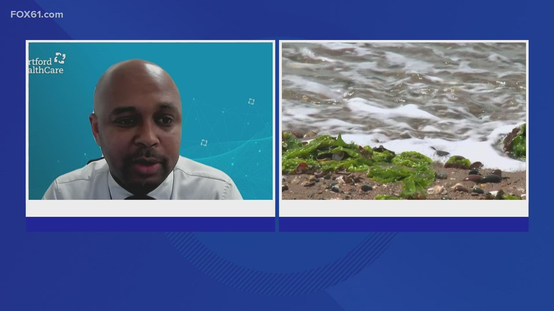 Greenwich warning residents of 'Swimmer's itch' | fox61.com