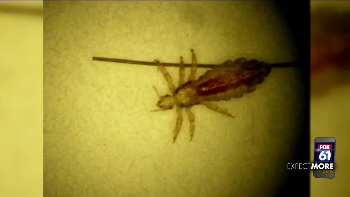 Doctors warn people of head lice in Halloween masks | fox61.com