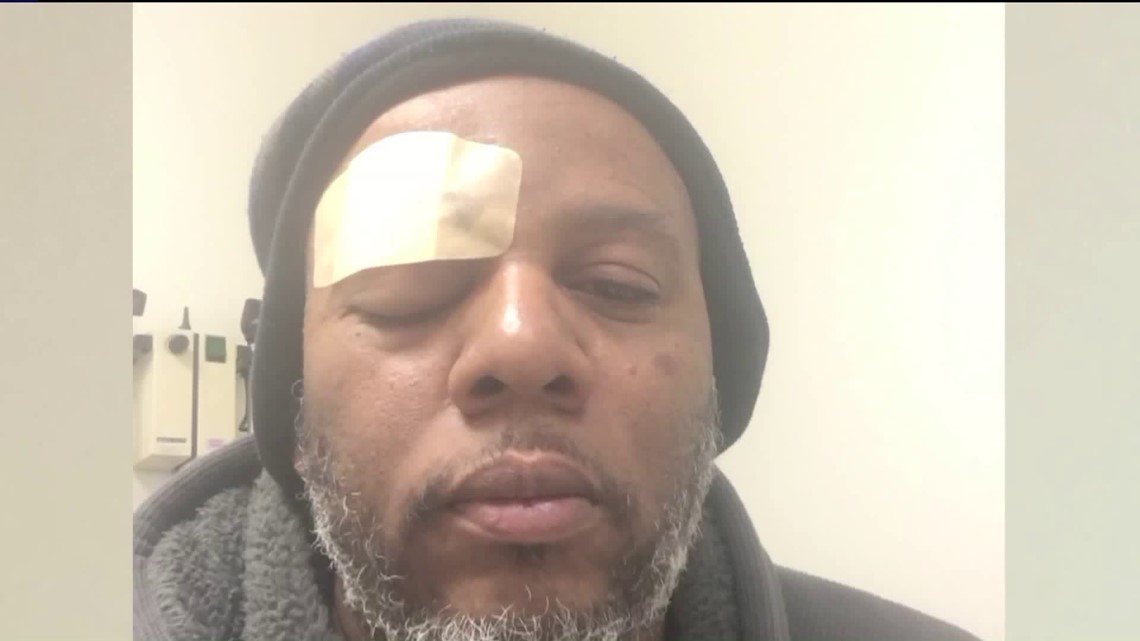 Fired CTtransit bus driver says he doesn’t remember attacking passenger ...
