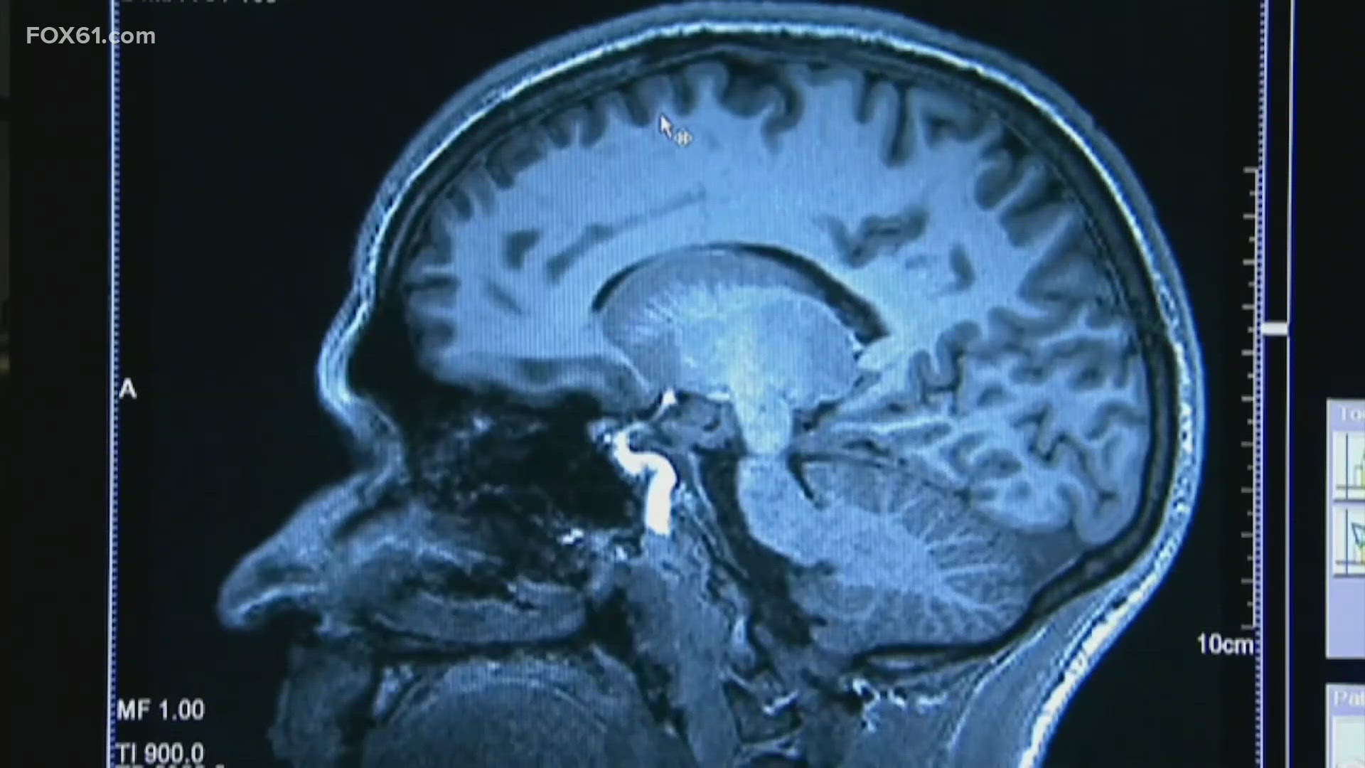 Senate considers limiting Trump's war powers after Venezuela raid ...