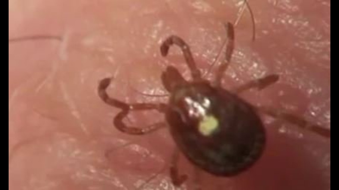 With increase in ticks comes possibility of more dangerous diseases ...