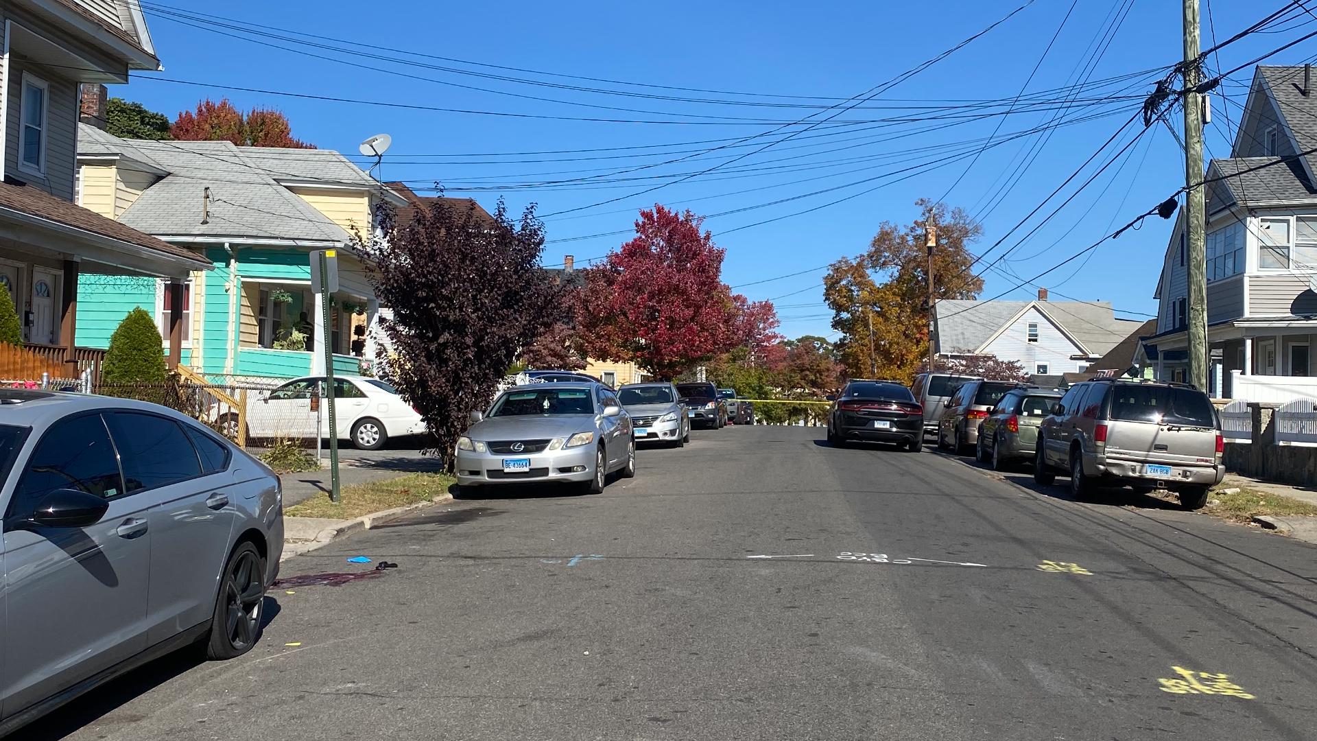 Bridgeport shooting leaves man in critical condition: PD | fox61.com