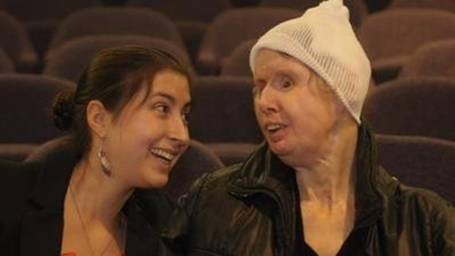 Chimp Attack Victim Charla Nash Loses Bid To Sue State | fox61.com