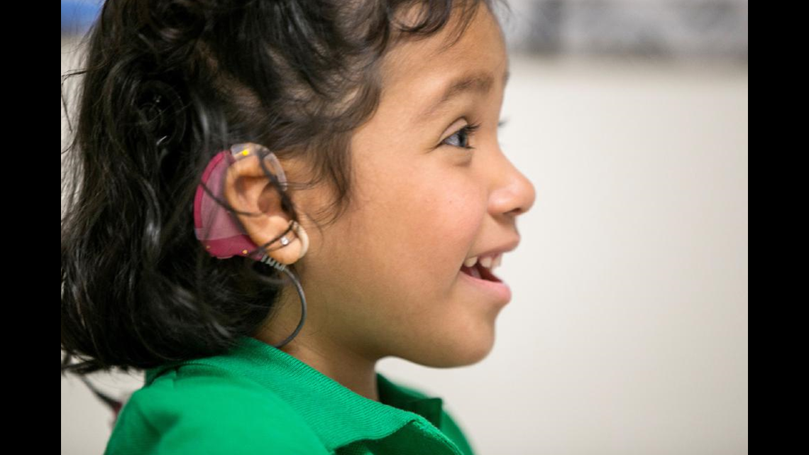 New study shows brainstem implants can help deaf children hear | fox61.com