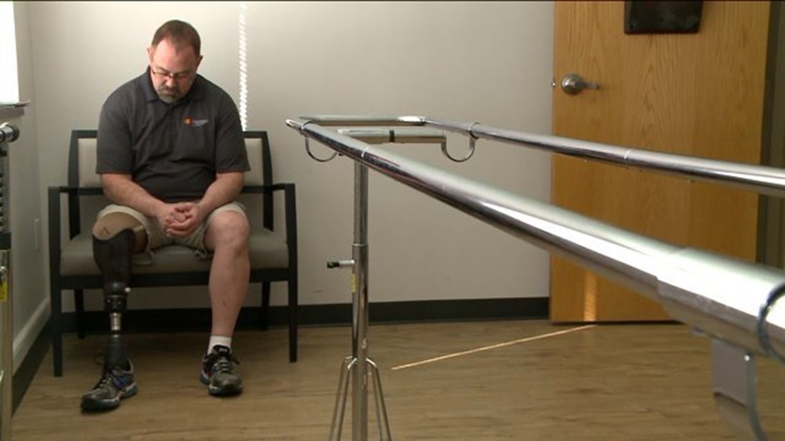 Manchester resident is first man to ever use Bluetooth prosthetic ankle ...