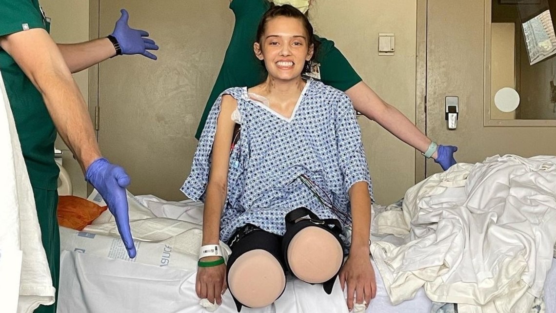 St. Pete model who lost legs during COVID battle returns home | 10tv.com