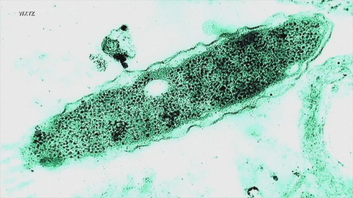 What is Legionnaires' disease? 21 cases, 1 death reported in Iowa ...