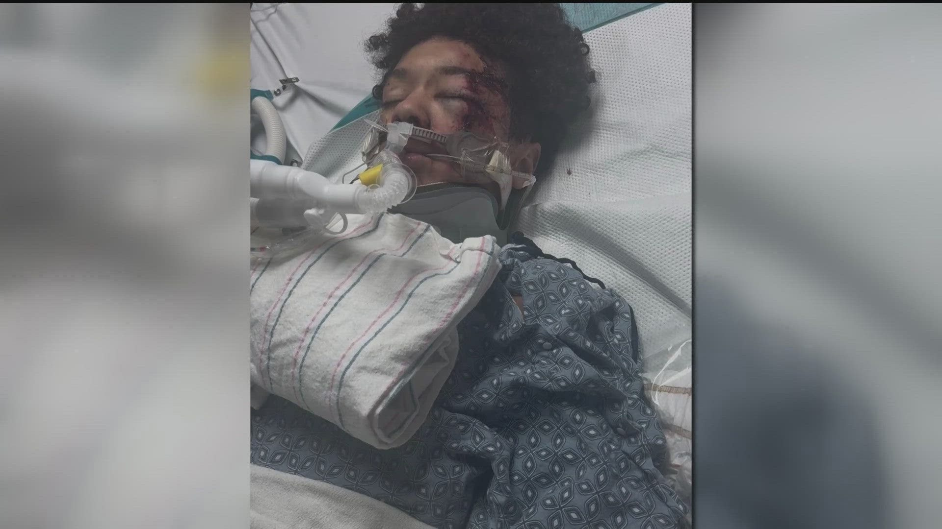 Family of metro Atlanta boy hurt in deadly ATV crash questions safety ...
