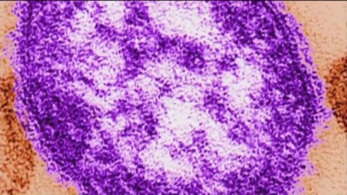 Georgia health officials report first measles case of 2026 in baby too ...