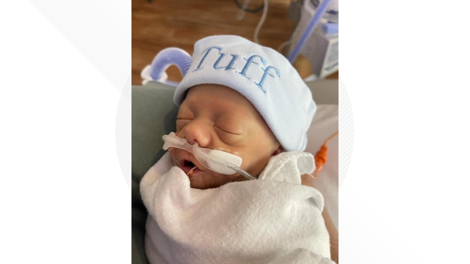 Georgia toddler defies odds, born at 22 weeks in NICU | fox61.com