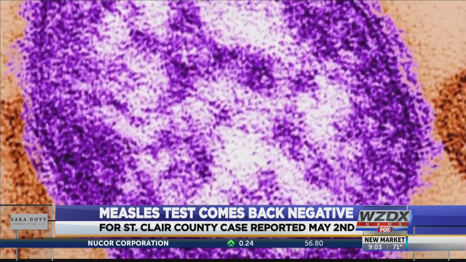 BREAKING: First presumptive positive measles patient in Alabama tests ...