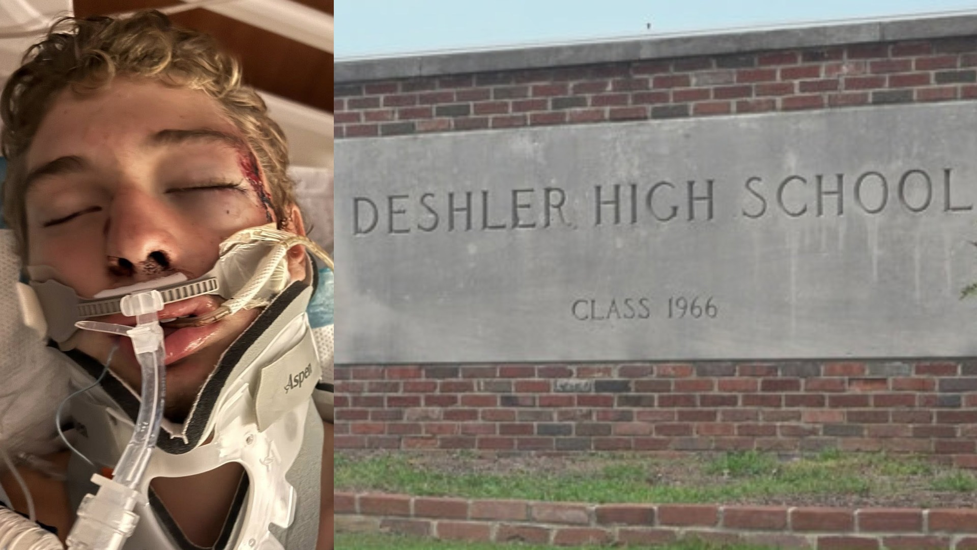 Tuscumbia Schools offer support after student injury | rocketcitynow.com