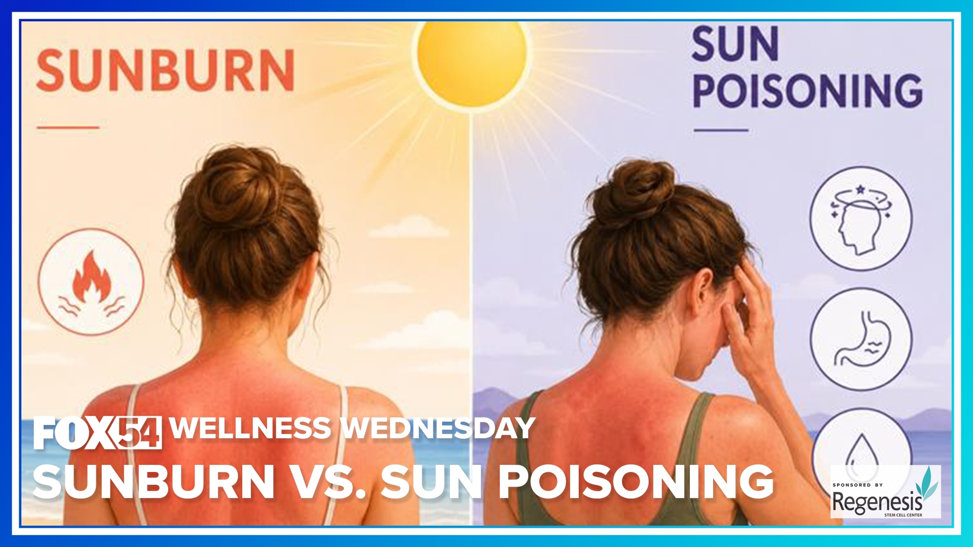 Wellness Wednesday: Understanding the difference between sunburn and ...