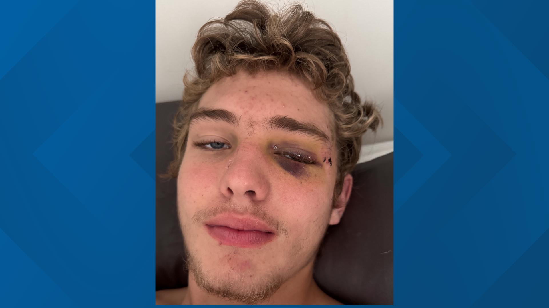 Alabama student's family seeks answers after injury | wqad.com