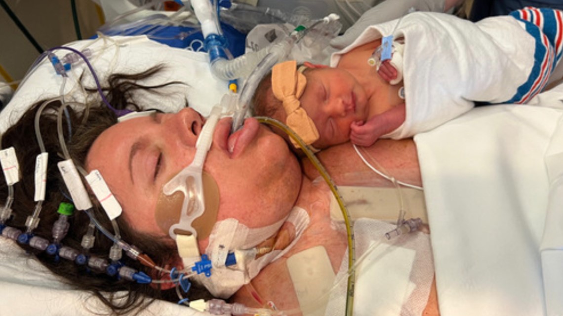 Michigan mom delivered her baby, survived open heart surgery | 10tv.com